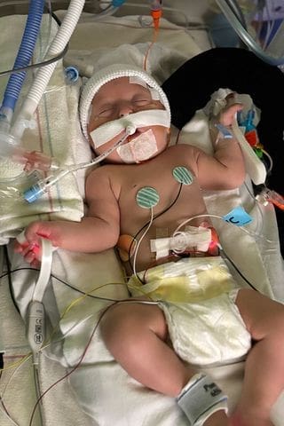 Courageous Baby Undergoes Life-Altering Surgery | Miami Daily Life