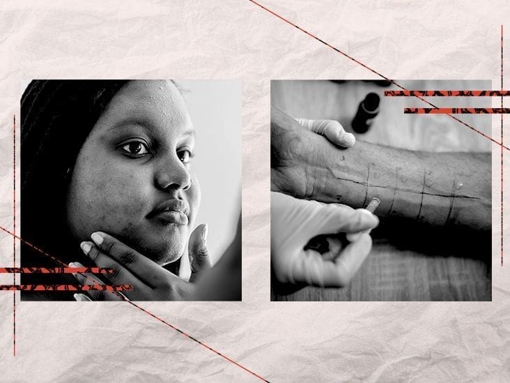 Understanding Skin Rashes Causes, Symptoms, and Treatments | Miami ...